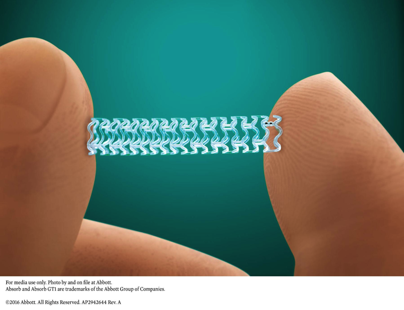 Lessons We Can Learn From the Abbott BVS Data - Cardiac Vascular News