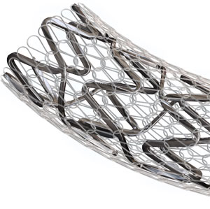 InspireMD's CGuard Carotid Embolic Prevention System Featured in Live ...