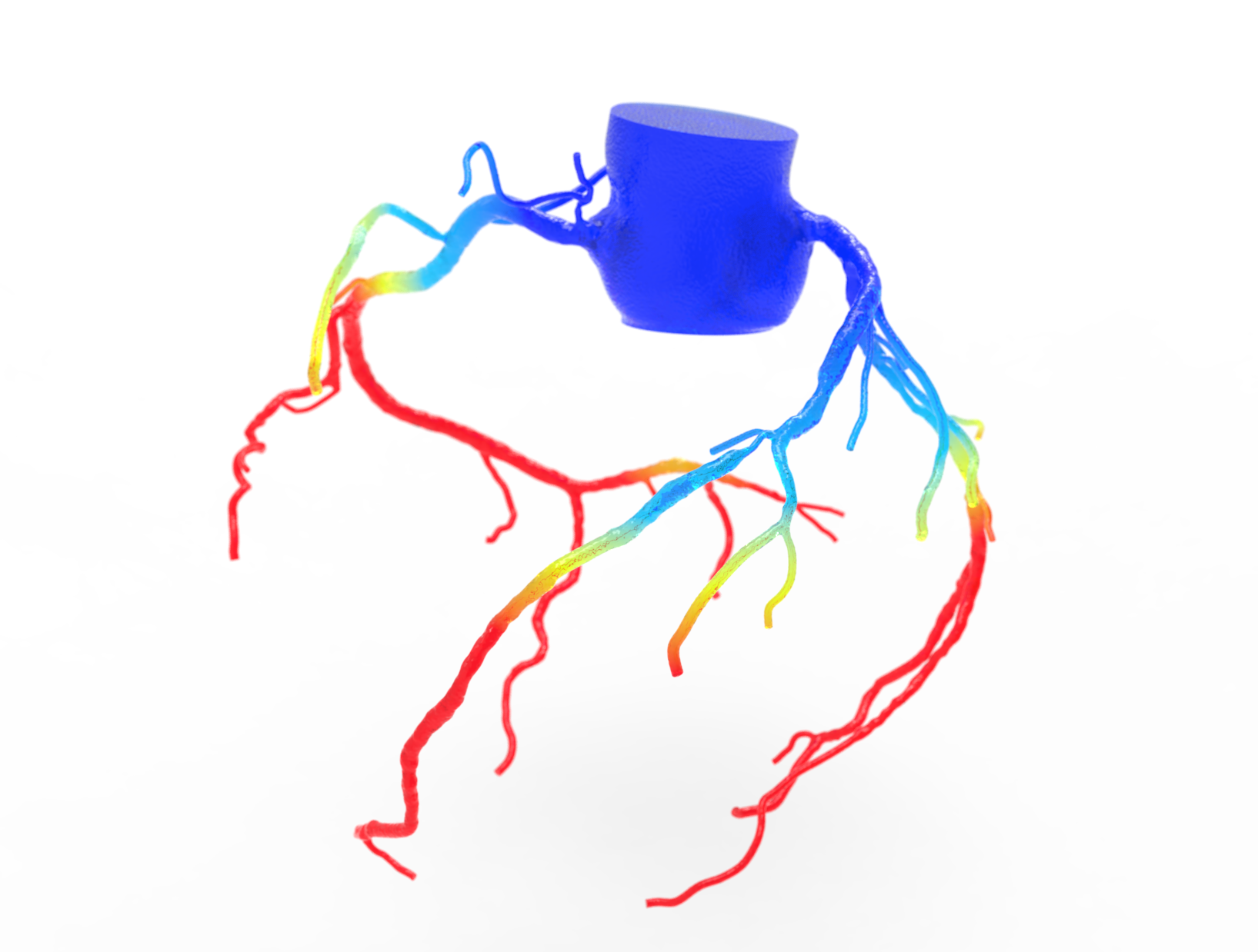 HeartFlow: Using AI to Recognize Heart Disease Fast – Cardiac Vascular News