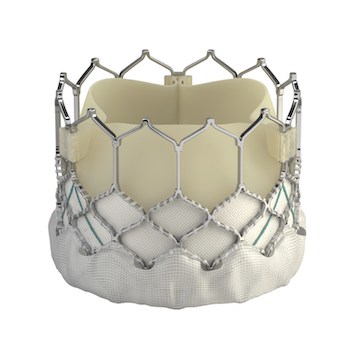 Edwards SAPIEN 3 TAVI Receives Expanded Approval In Europe - Cardiac ...