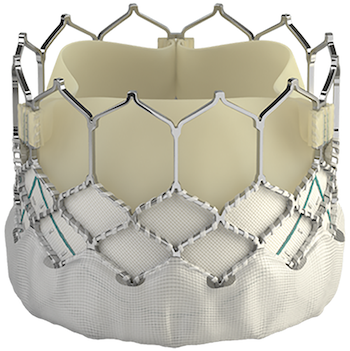 Edwards SAPIEN 3 Transcatheter Heart Valve Receives Approval In China ...