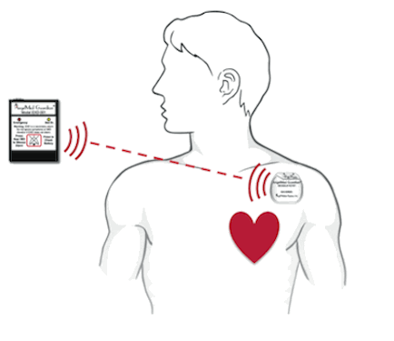 AngelMed Announces CMS Approval of Transitional Pass-Through (TPT ...
