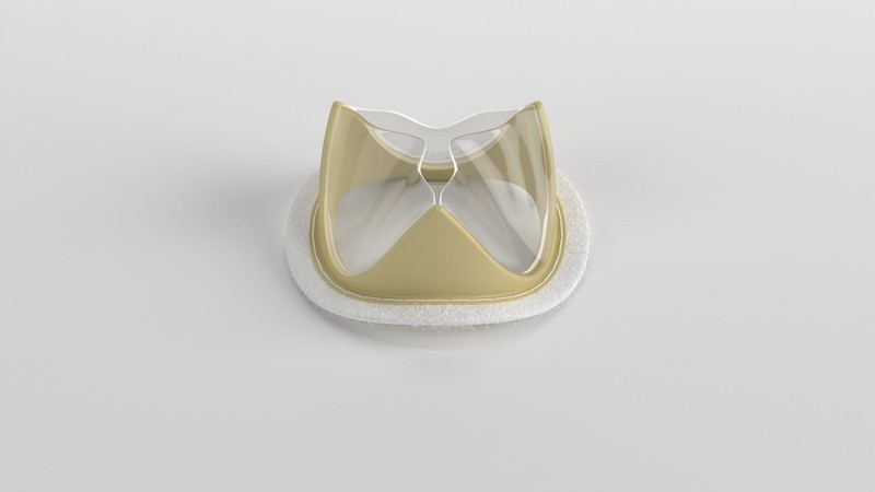 First Clinical Study on TRIA Biopolymer Heart Valve Shows Excellent One ...