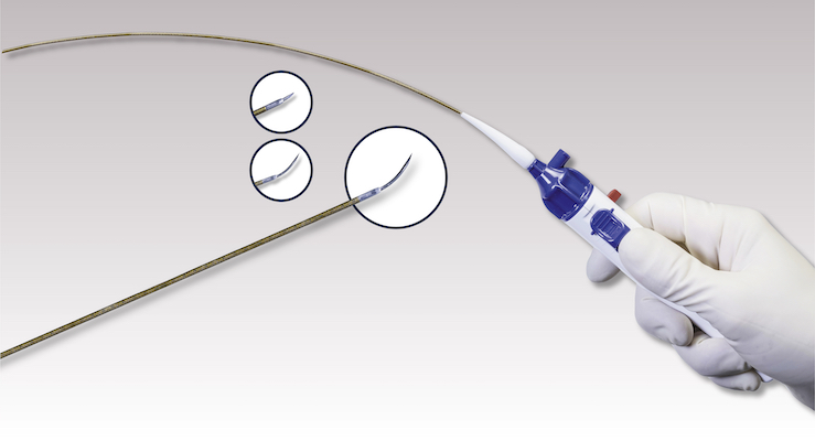 Upstream Peripheral’s GoBack CTO Catheter Aces its Exam - Cardiac ...