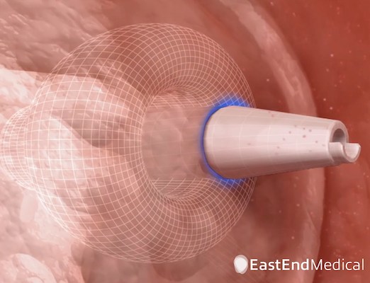 East End Medical Announces First Commercial Use of its Novel All-in-One ...