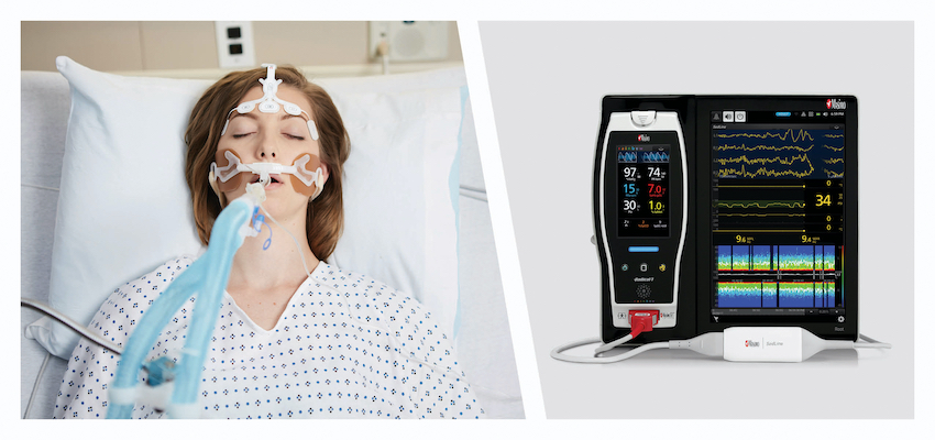 Masimo SedLine® Brain Function Monitoring Reduced the Use of Anesthetic ...