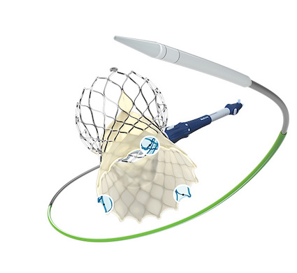 Medtronic’s Next-Gen Evolut™ FX TAVR System Shows Significant ...