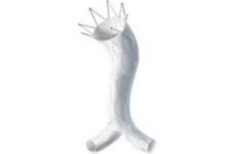 TERUMO AORTIC ANNOUNCES FIRST IMPLANT OF INNOVATIVE CUSTOM-MADE ...