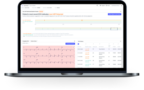 Anumana Receives U.S. FDA 510(k) Clearance for ECG-AI Algorithm to ...