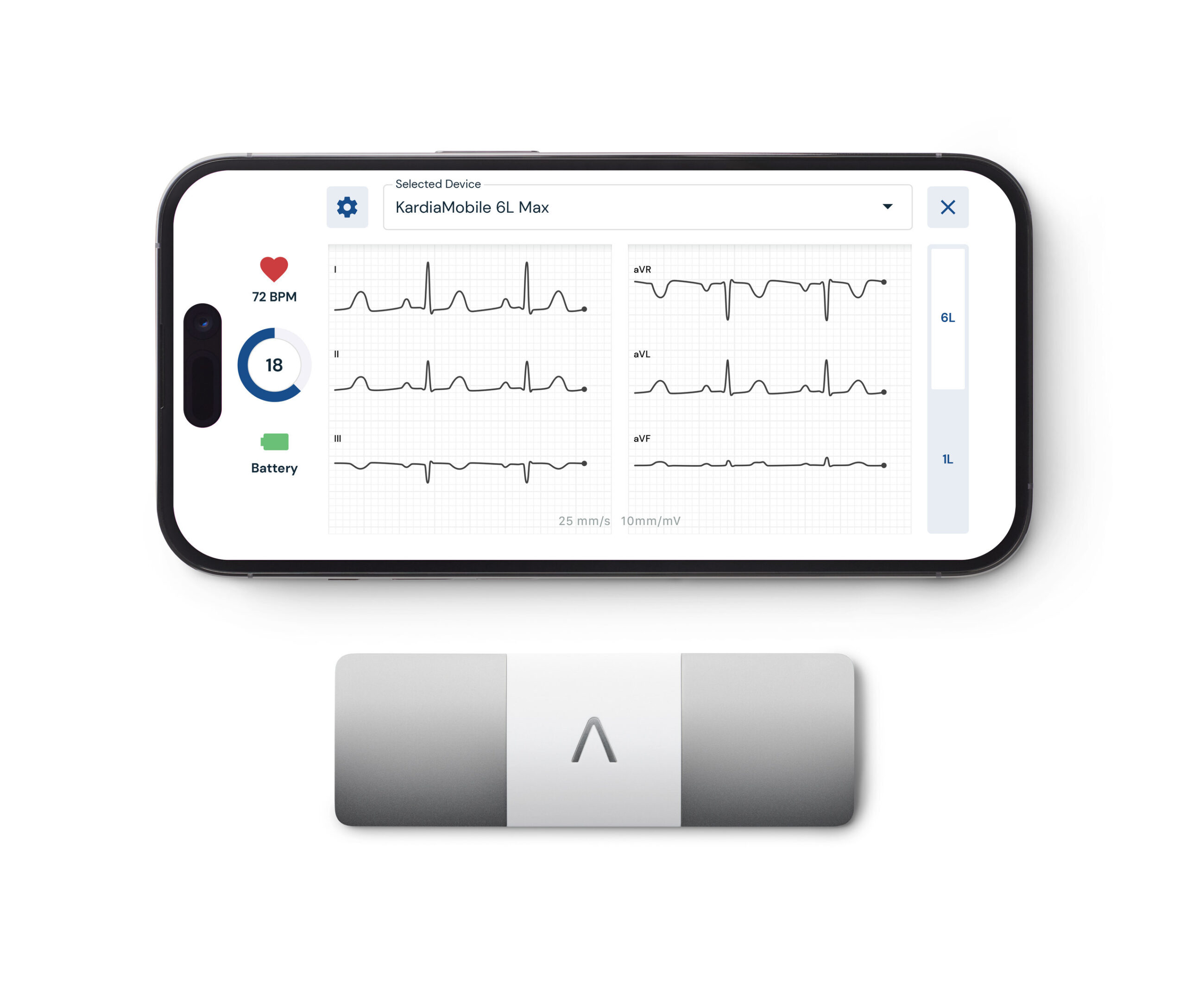 AliveCor Launches AI-Powered KardiaMobile 6L Max and KardiaAlert to ...