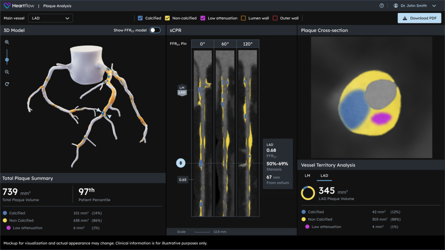 Heartflow Announces FDA 510(k) Clearance and Launch of Next Generation ...